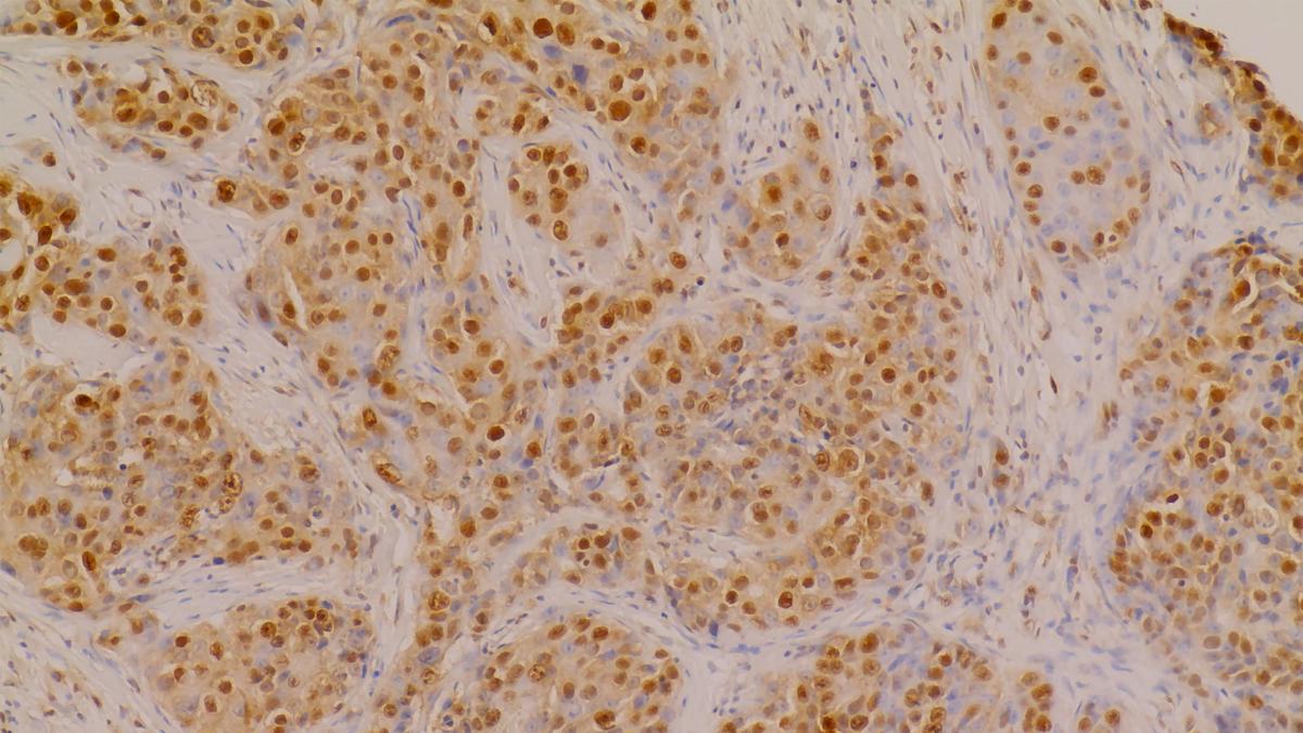 First-of-its-kind Survey Reveals American Catholics’ Attitudes Toward Jews Have Improved in Last ...